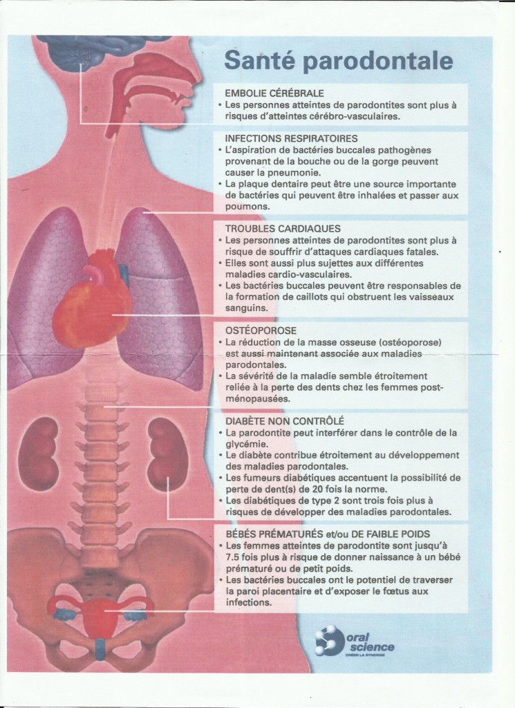 Les parodontopathies - Médecine Intégrée