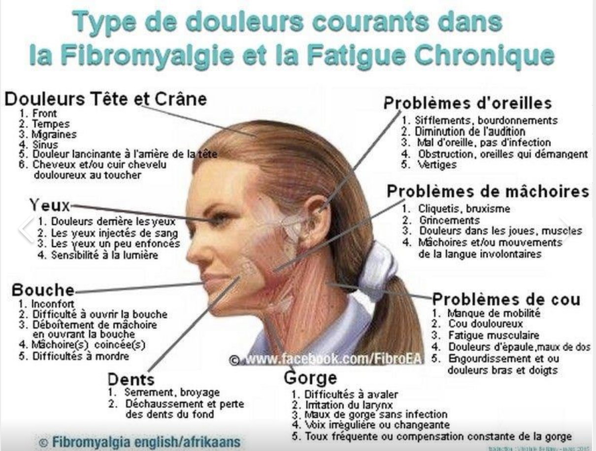 Fibromyalgie - Médecine Intégrée Fibromyalgie - Médecine Intégrée
