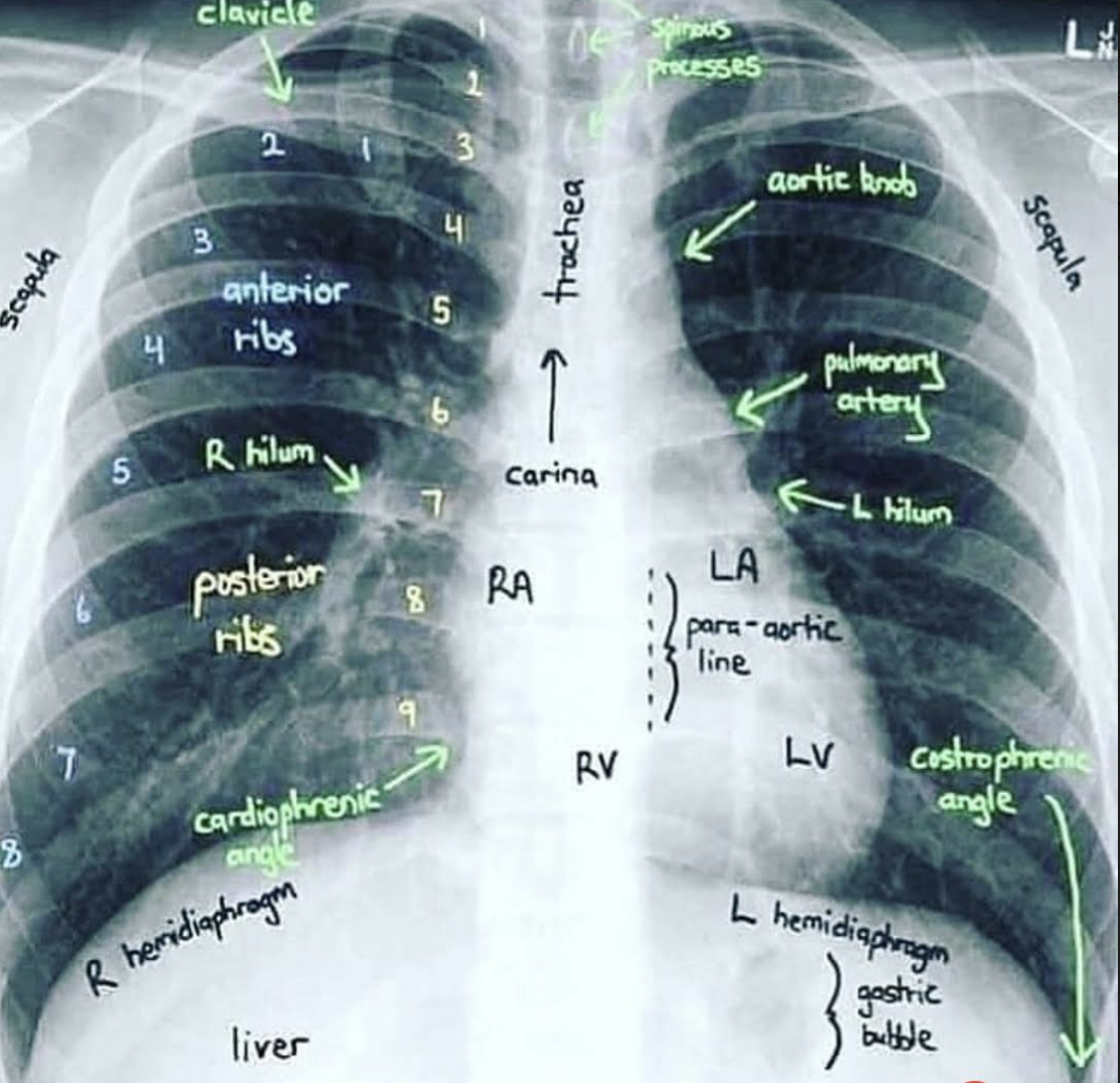 Le système respiratoire (Marieb ch.22) - Médecine Intégrée