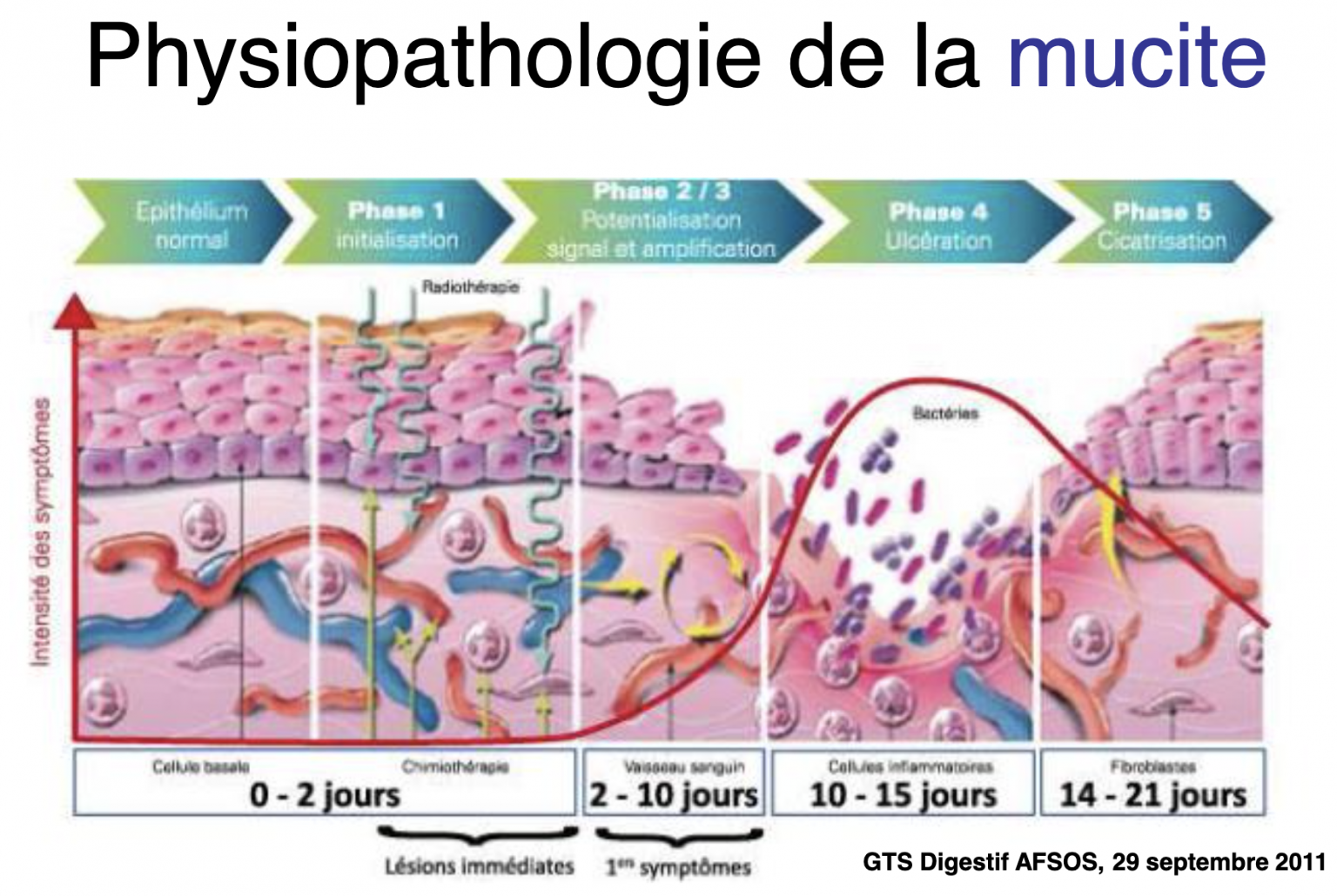 La mucite - Médecine Intégrée