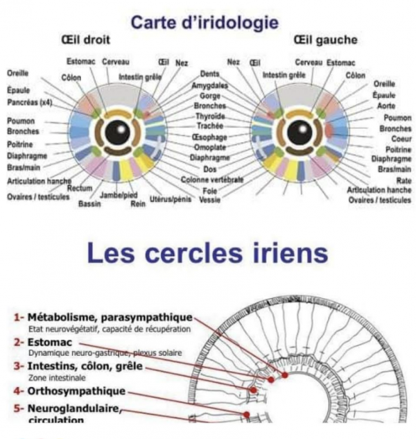 L'iridologie - Médecine Intégrée