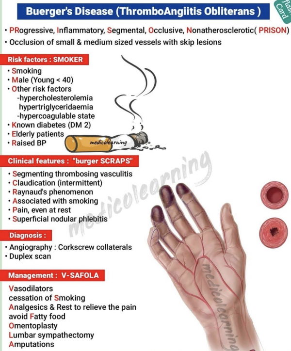 Maladie de Buerger - Médecine Intégrée