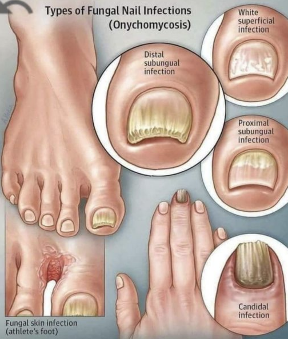 Ongles - Médecine Intégrée