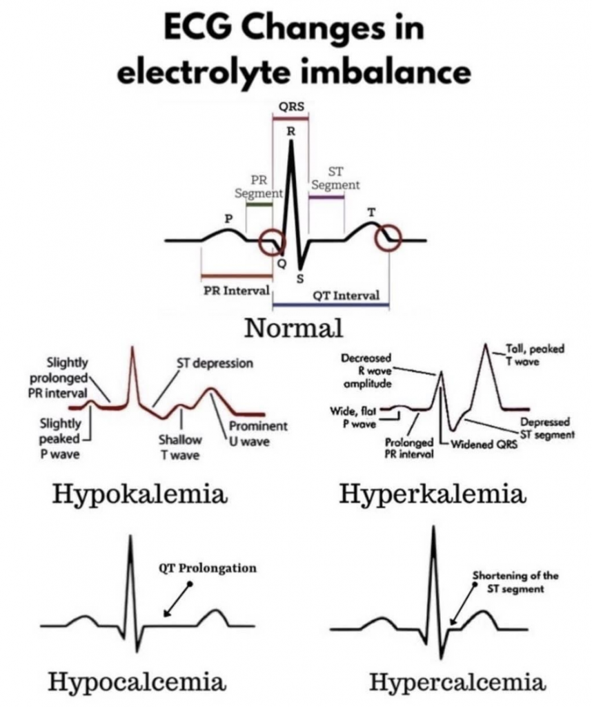 Le ionogramme - Médecine Intégrée