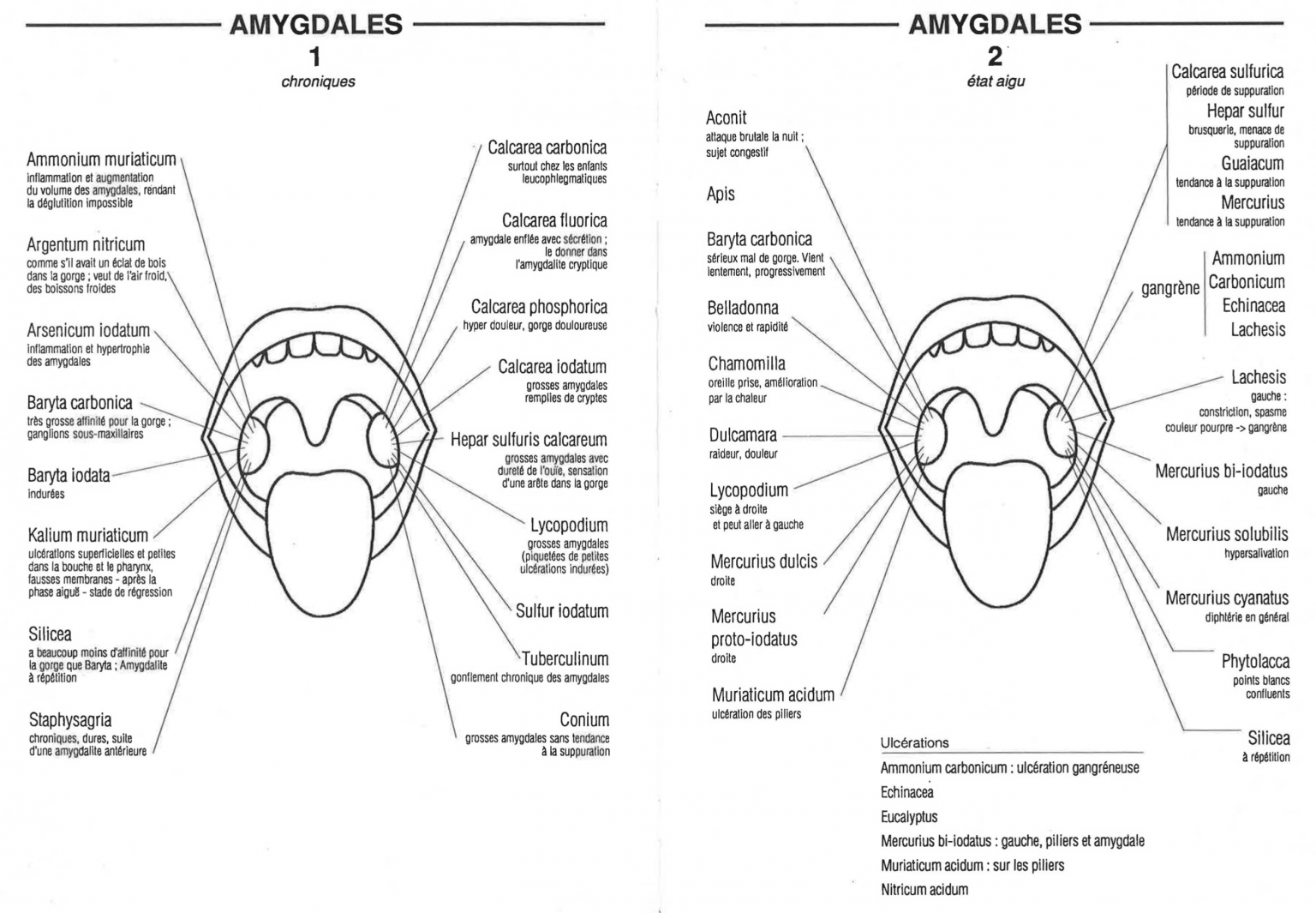 Les angines - Médecine Intégrée