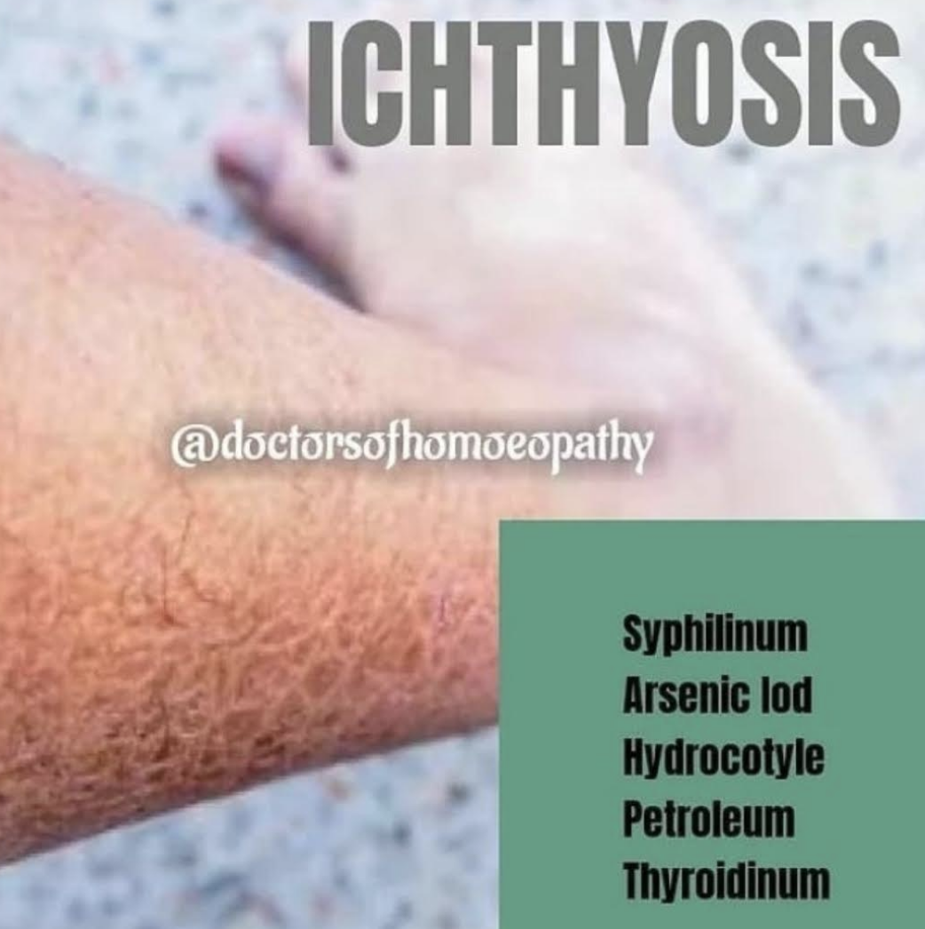L'ichtyose - Médecine Intégrée