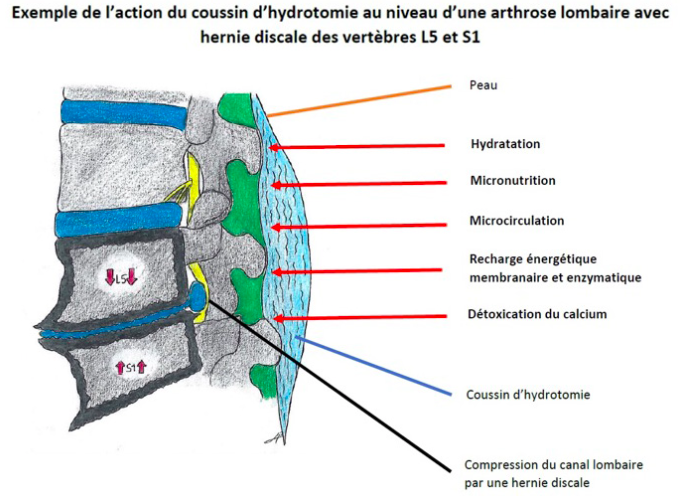 Plasma de Quinton - Médecine Intégrée