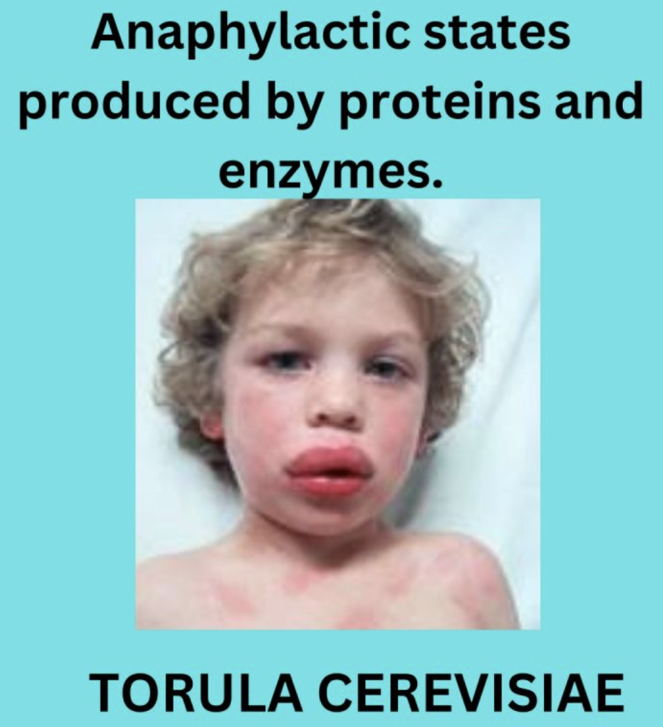 Torula cerevisiae - Médecine Intégrée