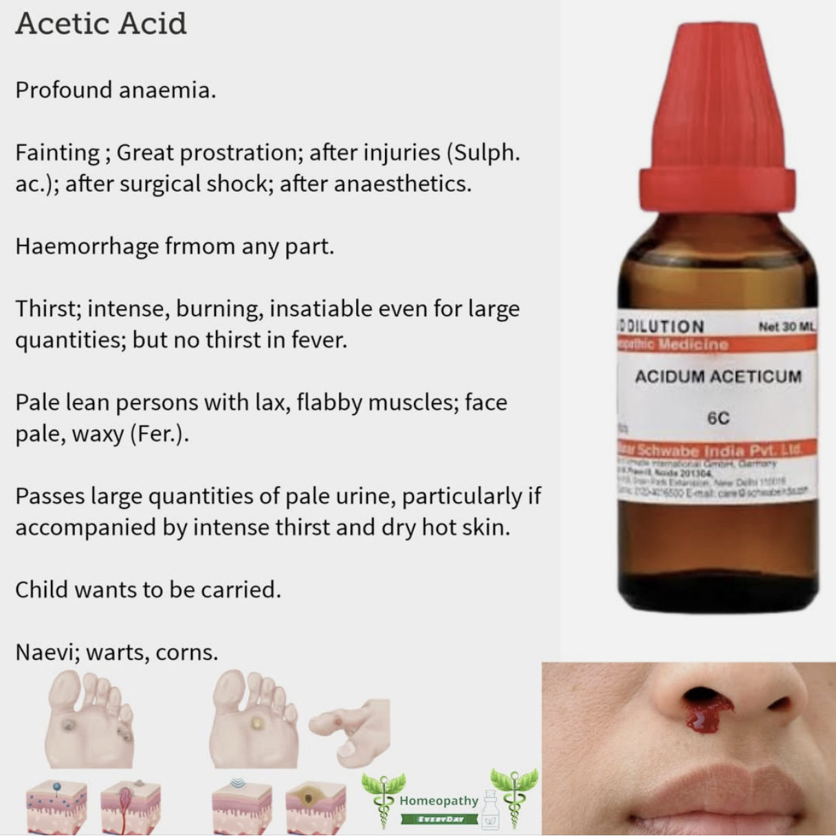 Aceticum acidum - Médecine Intégrée